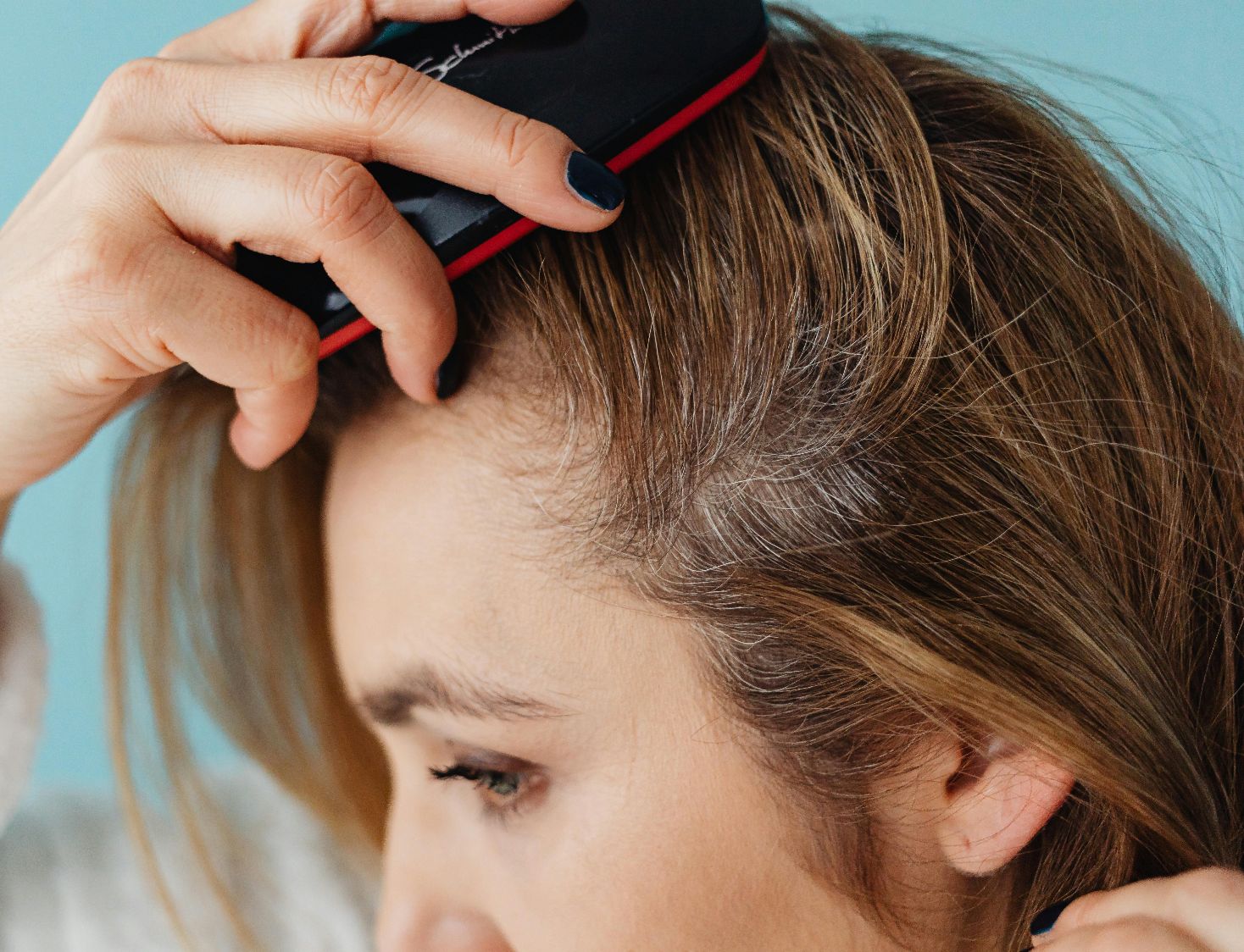 Dandruff: 10 Causes of White Flakes & 10 Ways to Keep Your Scalp ...